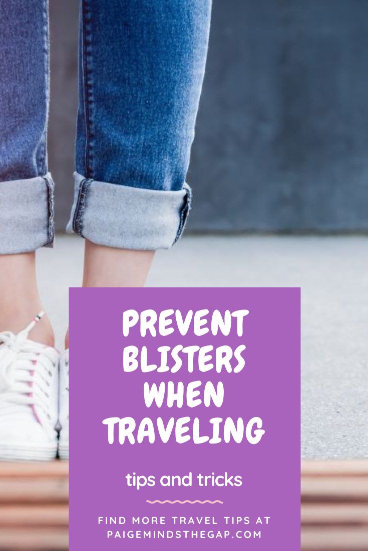 How to Prevent Blisters When Traveling